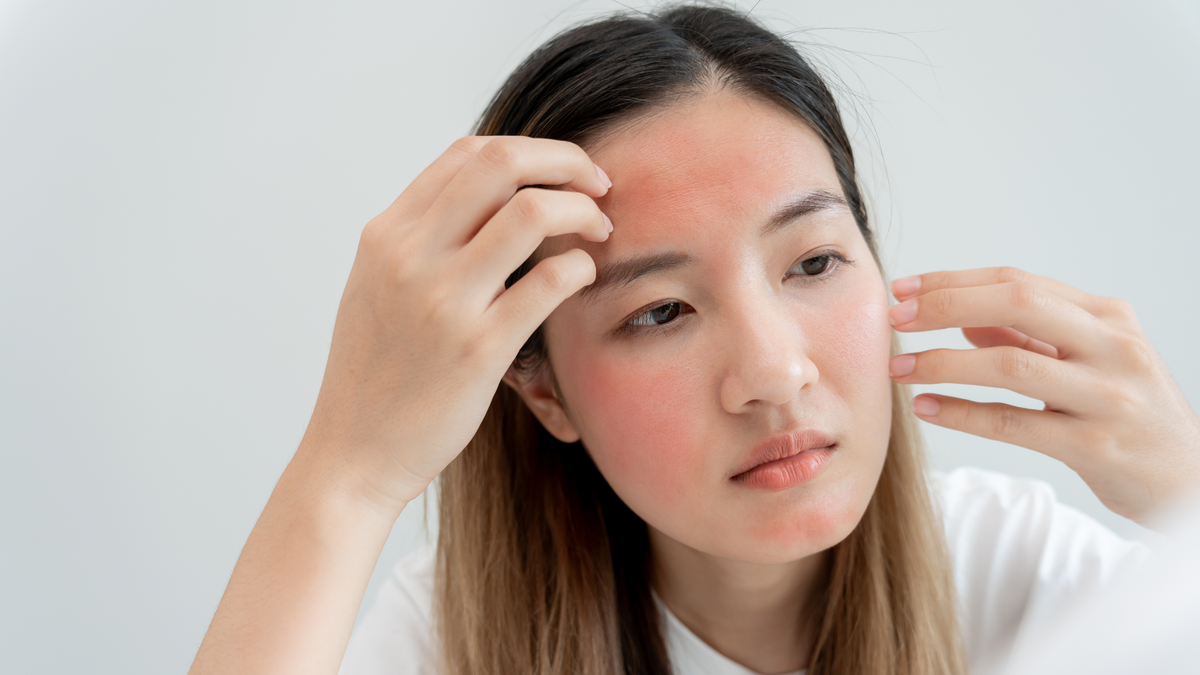 How to Manage Histamine Reactions for Healthier Skin – Nature's Nectress